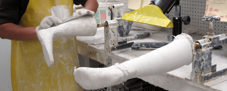 Prosthetics | Brace IT Orthotics and Prosthetics